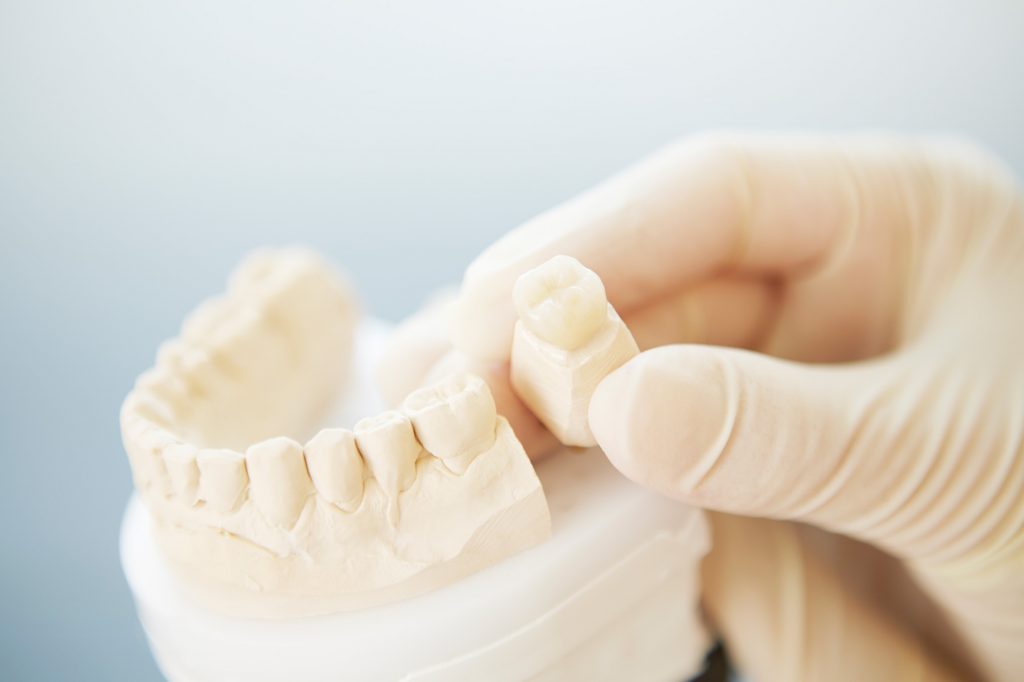 Operative Zahnentfernung - Dr. Pawlenka